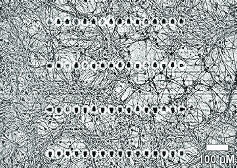 Dissociated Frontal Cortex Network On A Multielectrode Neurochip After