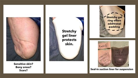 Residual Limb Awareness Understanding And Mastering Your Above Knee Ak Transfemoral Residual