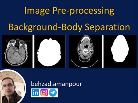 behzad amanpour on linkedin machinelearning python radiology