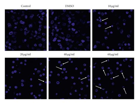 Dapi Staining And Flow Cytometry Analysis Of Apoptotic Death Of Download Scientific Diagram