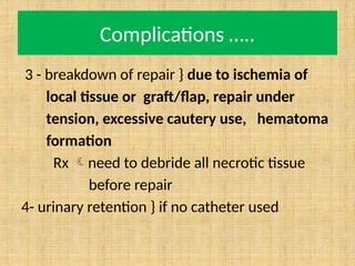 02 Hypospadiasurology Lecture Kcmc Hospitalpptx Pptx