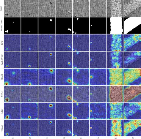 Visualisation Of Abnormal Segmentation Results On The Shenzhen Download Scientific Diagram