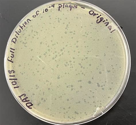 The Actinobacteriophage Database Phage Bronty