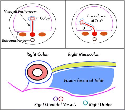 Drawing Showing The Embryological Development Of The Fusion Fascia Of