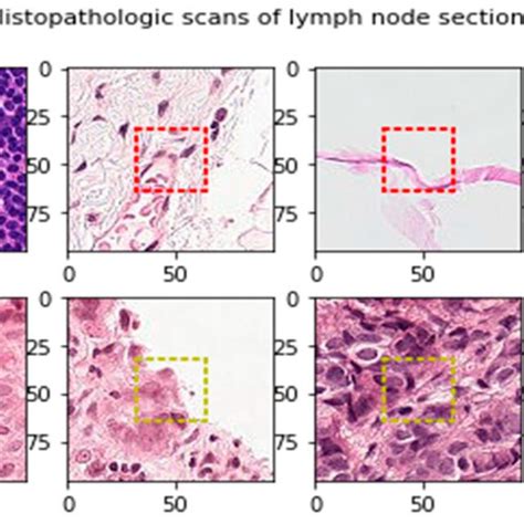 Lymph Node Sections Extracted From Digital Histopathological Download Scientific Diagram