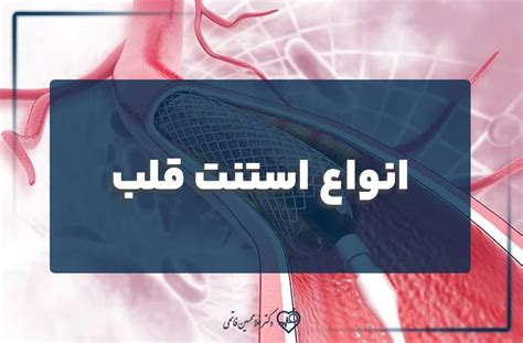 استنت قلب چیست؟ دکتر فاتحی