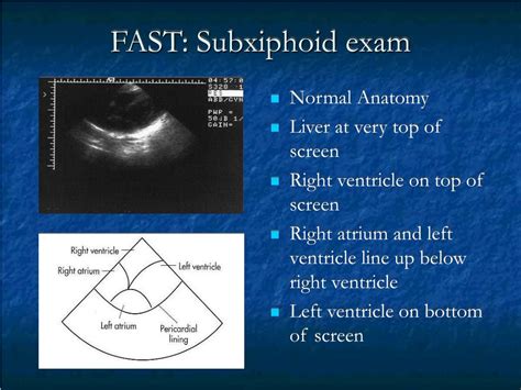 PPT Introduction PowerPoint Presentation Free Download ID