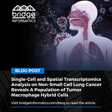 Bridge Informatics On Linkedin Cancer Nsclc Bioinformatics Scrnaseq Spatialtranscriptomics