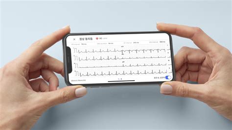 If Design Hativ Ecg Analyzer App