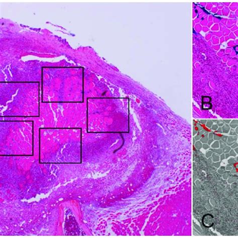 Bacterial Quantification To Evaluate The Correlation Between The Bacterial Quantification To Evaluate The Correlation Between The