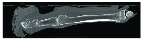 Sagittal Ct Image Bone Algorithm Ww1500 Wl300 From Postmortem Download Scientific Diagram