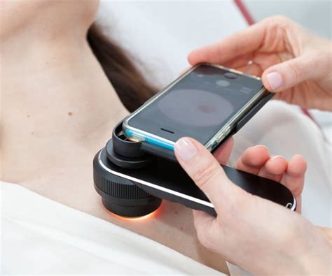 Artificial Intelligence Detects Skin Cancer Better Than Docs