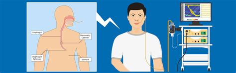 Manometry Test Manometry Procedure Manipal Hospitals