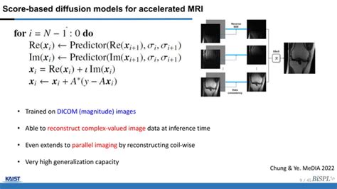 Score Based Diffusion Models For Accelerated MRI Pptx