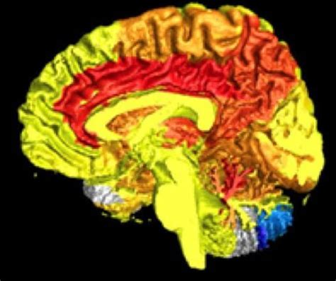 Women Have More Active Brains Than Men Neuroscience News