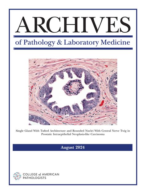 Prevalence Of Syphilis Serology Testing Algorithm Among Laboratory