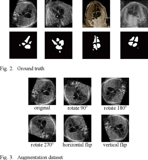 Figure 2 From Histogram Equalization Methodologies Comparison For Deep Learning Model In Fetal