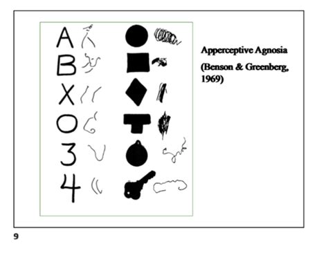 Visual Processing Streams And Agnosia Flashcards Quizlet