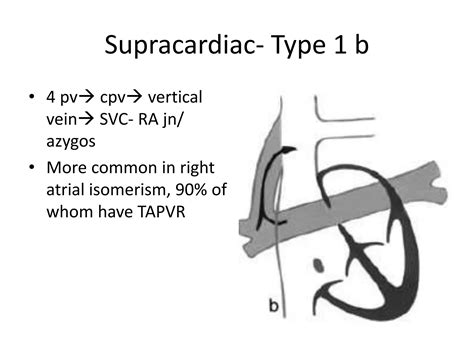 Classification And Pathophysiology Of Tapvc Pptx