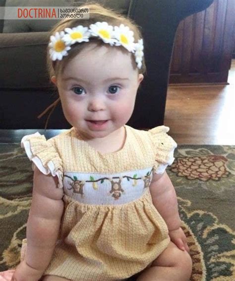 დღეს დაუნის სინდრომის საერთაშორისო დღეა საინტერესო ფაქტები Doctrina