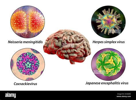 Viral Meningitis Structure