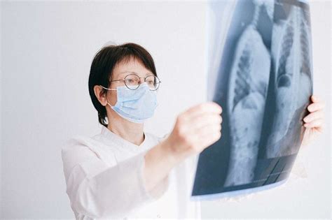 Atelectasis 10 Atelectasis Symptoms