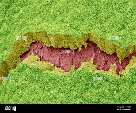 Gall Bladder Coloured Scanning Electron Micrograph Sem Of The Surface Of A Gall Bladder This