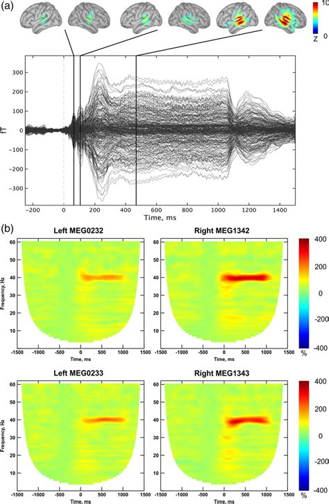 The Grand Average Sensor Space Visualization A ‘butterfly Plot The Download Scientific