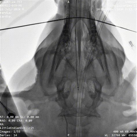圆满结束 探索血管介入手术新纪元，共鉴科技与医疗的深度融合 脑医汇