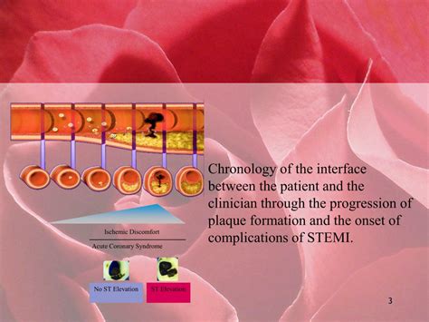 PPT STEMI MANAGEMENT PowerPoint Presentation Free Download ID