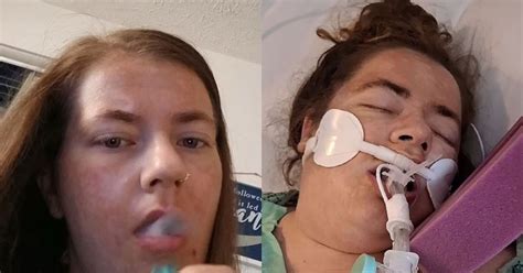 “입에서 검은 점액 주르륵”… 폐에도 검은 액체 가득 30대 美 여성 무슨 일