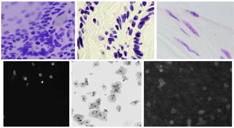 Automated Nucleus Detection With Deep Learning
