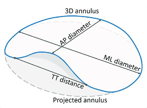 Quantification Parameters Of The Mitral Annulus The Full Blue Curve Download Scientific