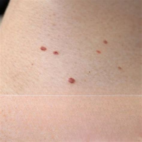 Understanding Red Spots On The Skin Causes Care And When To Pay