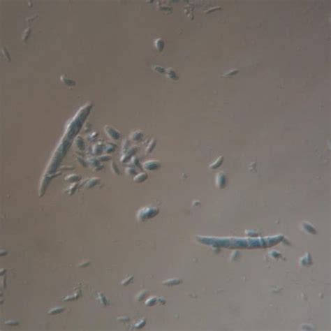 Microscopic Characterization Of Fusarium Proliferatum Download Scientific Diagram