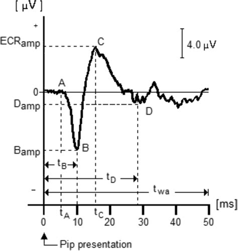 Typical Electrical Cochlear Response Ecr Morphology It Is Generated