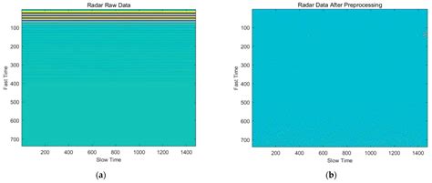 Sensors Free Full Text A Vital Signs Fast Detection And Extraction