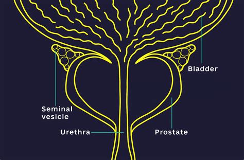 Prostatitis Types Causes And When To Seek For Help