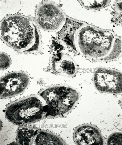 Corynebacterium Diptheriae Stock Image Science Source Images