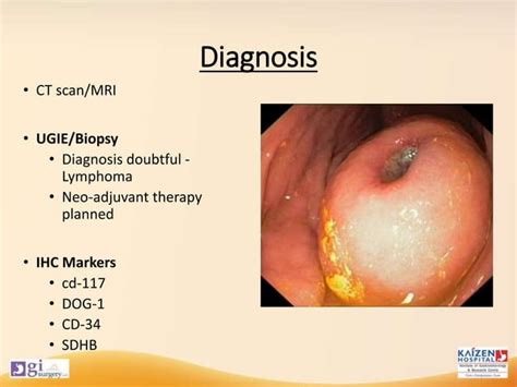 Gastric Gist By Dr Harsh Shah Ppt