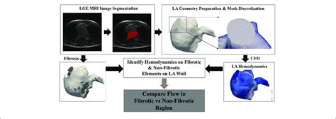 workflow of the personalized computational fluid dynamic cfd