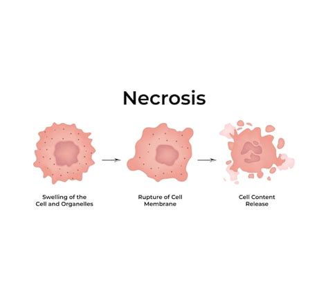 Premium Vector Necrosis Cancer Development Normal Cell Cancer Cell