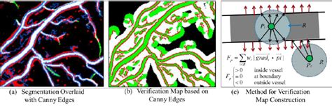 A Segmentation Based On Vesselness Filtering Overlaied With Detected