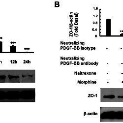 PDGF BB Induces Down Regulation Of ZO In HBMECs