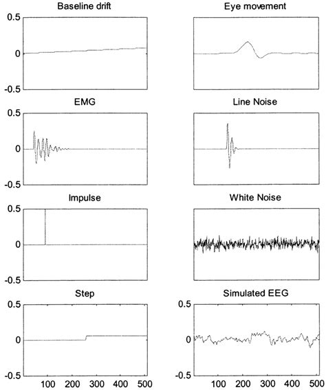 Seven Types Of Simulated Artefactnoise And Simulated Eeg Download Scientific Diagram Seven Types Of Simulated Artefactnoise And Simulated Eeg Download Scientific Diagram