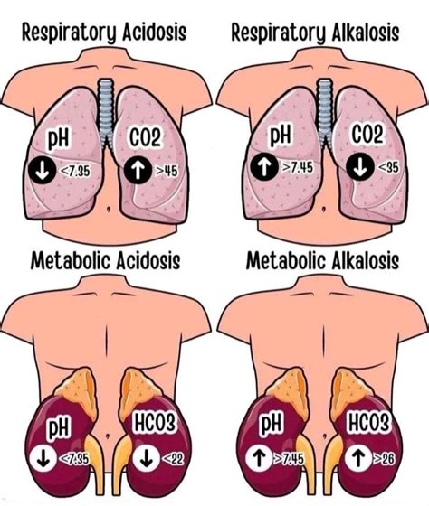Arterial Blood Gas Abg Analysis Is An Essential Part Of Diagnosing