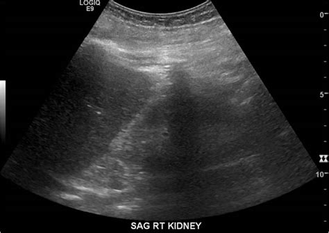 Dr Shannons Ultrasound Corner