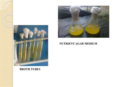 Isolation Of Protease Producing Microorganism Pptx Gardening Home