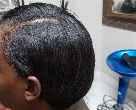 Home Fabulous Ronnie Hair Restoration Clinic