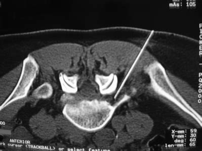 Injection Procedures Musculoskeletal Key